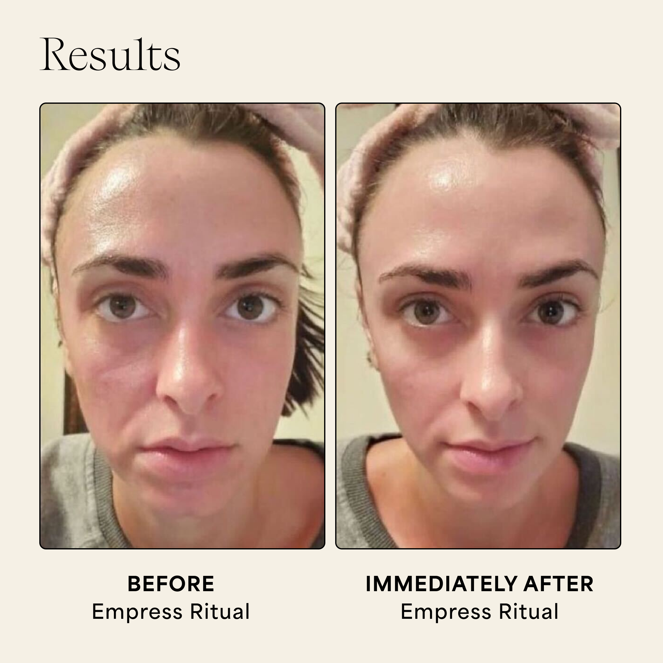 Empress Platinum Facial Gua Sha Stone | Wildling